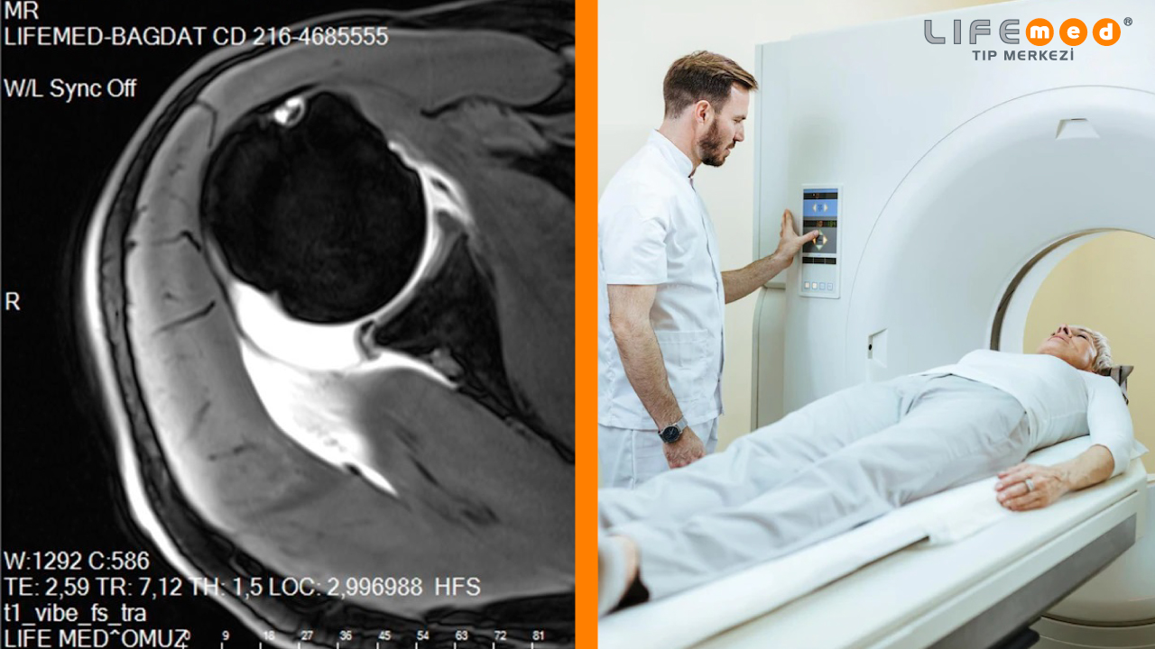 Ga-68 Dotatate - Lifemed