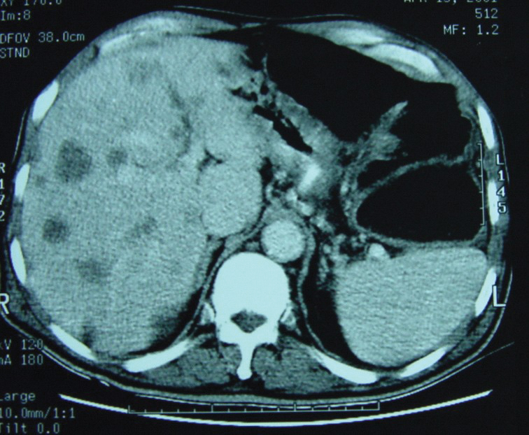 Multislice Computed Tomography 128 Slice - Lifemed