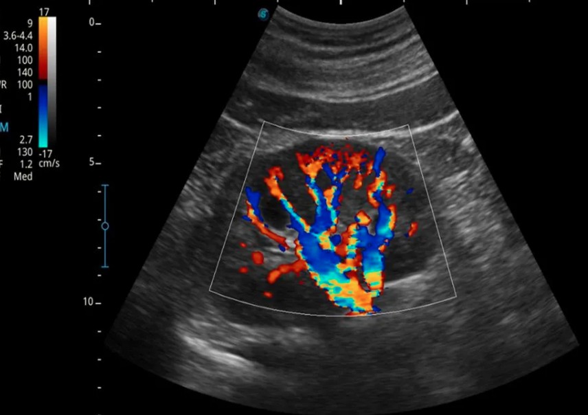Color Doppler Ultrasonography - Lifemed
